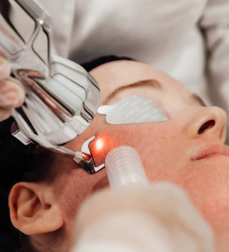 ProFractional Laser Skin Resurfacing | Serving Vancouver & Surrey